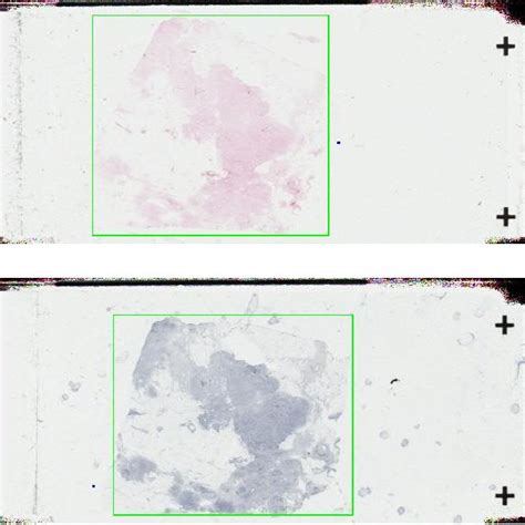 Color Deconvolution Applied To An Hande Stained 256µm × 256µm Frame Download Scientific Diagram
