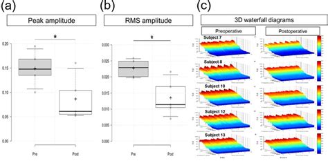 Spectro Temporal Analysis Of Signals Obtained Via Transcanal Sound Download Scientific Diagram