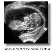 History Of Ultrasound In Obstetrics And Gynecology Part 3
