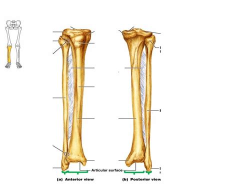 Fibula And Tibia Bone Markings Quiz