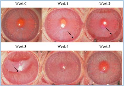 Observations Of Corneal Neovascularization Models Download Scientific Diagram