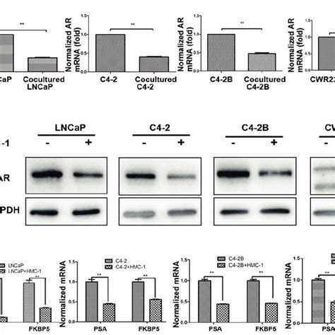Recruited Mast Cells Enhanced Pca Cell Invasion Via Alteration Of Ar