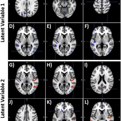 Clusters Associated With Latent Variables 1 LV1 And 2 LV2 Hot