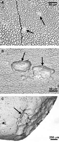 Examples Of Differently Sized Lesions On The Root Surface Resorptive