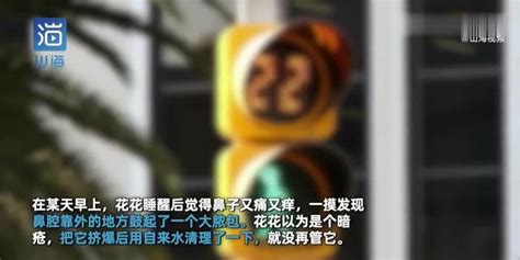 不要乱抠鼻子！00后女孩频繁挖鼻孔致颅内感染险丧命手机新浪网
