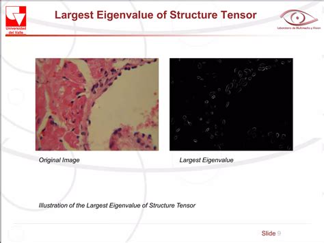 a cells segmentation approach in epithelial tissue using histology
