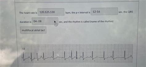 Solved The Heart Rate Is Bpm The P−r Interval Is Sec The