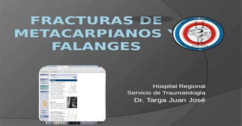 Fracturas De Metacarpianos [pptx Powerpoint]