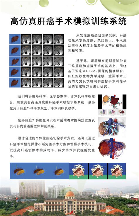 高仿真肝癌手术模拟训练系统 南方医科大学国家大学科技园