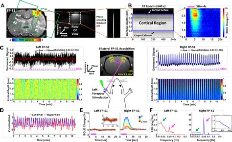 Figure 1 From Laminar Specific Interhemispheric Connectivity Mapping