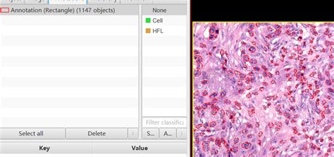 Question About Using Qupath Script To Detect Cells Image Analysis