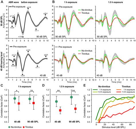 Grand Average Waveforms For The Click Evoked Abr In