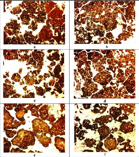 4 Vermicular Microstructure Of Organic Mineral Horizons Under Native Download Scientific