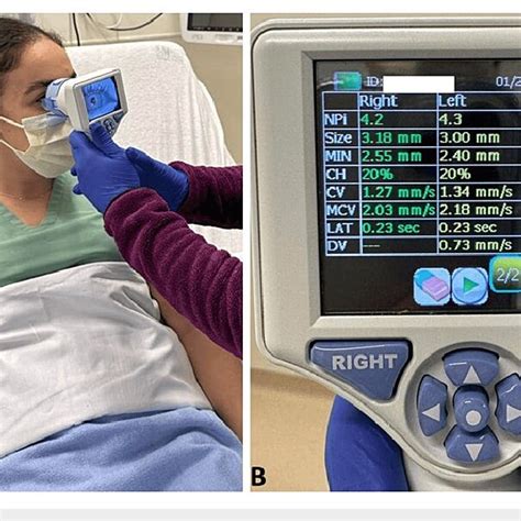 A Nurse Taking Automated Pupillometer Reading B Automated Download Scientific Diagram