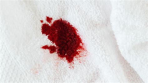 जानें Sex के बाद Bleeding कब नॉर्मल है और कब आपको चिंता की जरूरत