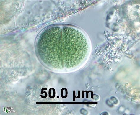 Chroococcus Turgidus Galerie