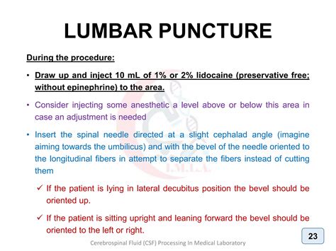 Csf Processing In Medical Laboratory 01 Pdf