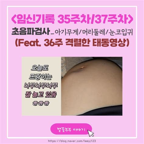 임신일기 35주 4일37주 3일초음파검사 아기무게36주 격렬한 태동영상막달검사 태동검사심전도검사 네이버 블로그