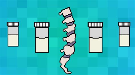 Cerebrospinal Fluid Interpretation CSF Interpretation Geeky Medics