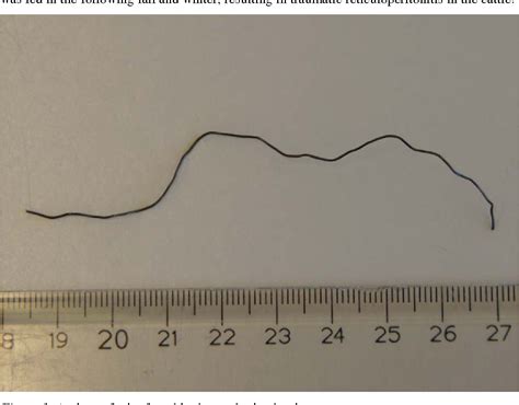 Figure 1 From An Unusual Cause Of Traumatic Reticulitis