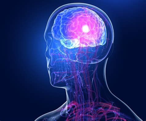 Hersenbloeding Vroegtijdige Waarschuwingssignalen En Risicofactoren