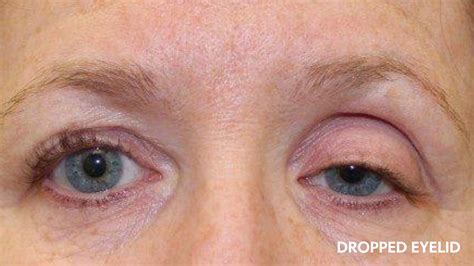 Botox Lueur Aesthetic Clinic