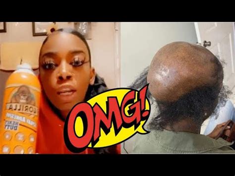 Update On Tessica Brown Tiktok Woman Who Used Gorilla Glue As Hair