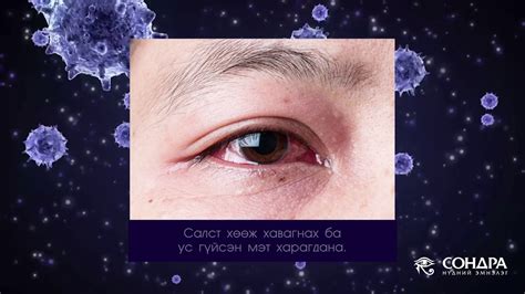 ТА НҮДНИЙ ХАНИАДНЫ ТАЛААР ХЭР МЭДЛЭГТЭЙ ВЭ Youtube