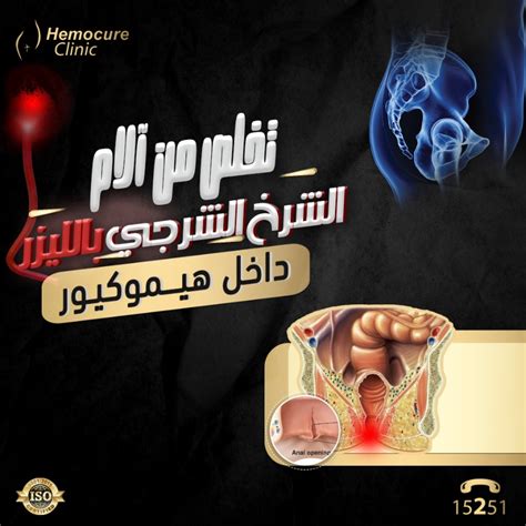 ع Hemocure Clinic هيموكيور لعلاج أمراض الشرج والمستقيم