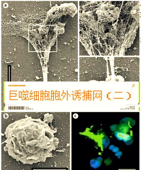 巨噬细胞胞外诱捕网的形成与功能