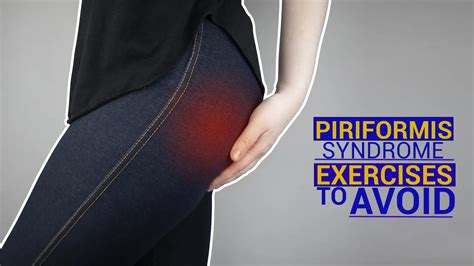 Piriformis Syndrome Exercises