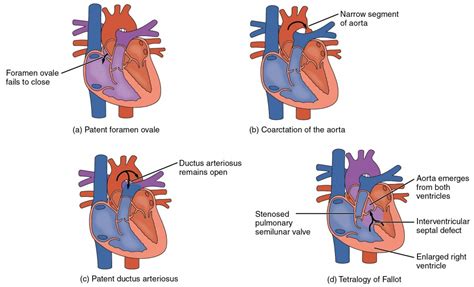 Heart Anatomy Anatomy And Physiology Ii