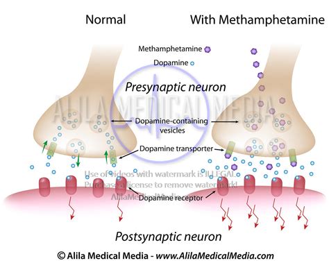 Alila Medical Media Action Of Methamphetamine On Dopaminergic Synapse