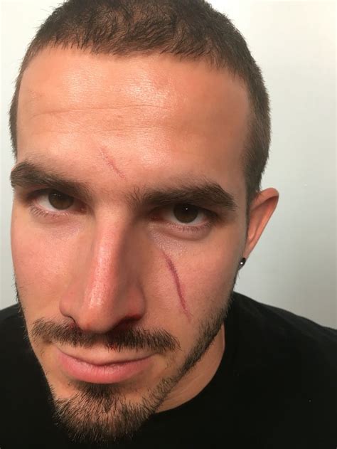 Face Scar Eye