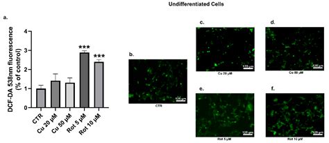 Copper Dependent Modulation Of α Synuclein Phosphorylation In Differentiated Shsy5y