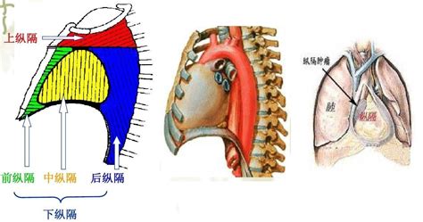 您了解什么是纵隔肿瘤吗 微医挂号网