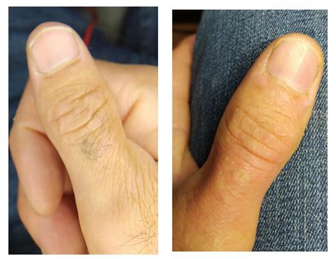 DIY Electrolysis Started R Transtimelines