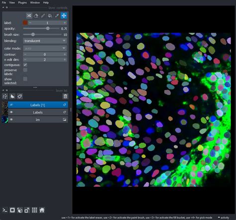 Review How Good Is Instanseg At Segmenting Nuclei Page 2 Image Analysis Imagesc Forum