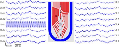 21 Simultaneously Recorded Raw Neural Electrophysiological Signals Download Scientific Diagram