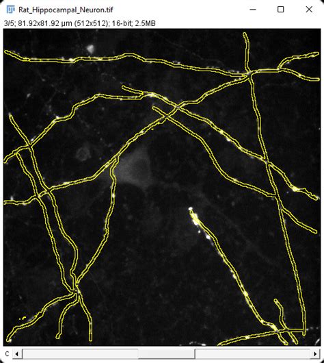 neuron segmentation image analysis image sc forum