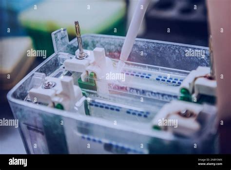 Western Blot Analysis Use As Protein Analysis For Protein Detection This Technique Use In