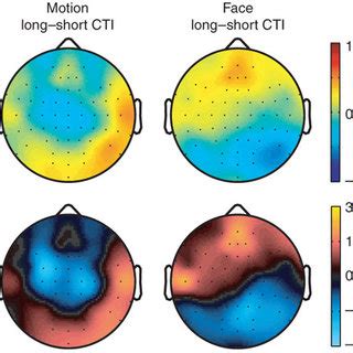 Mean Voltage Top And Z Score Bottom Scalp Maps Representing The