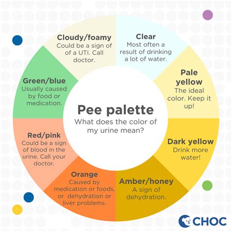 Lemon Color Pee