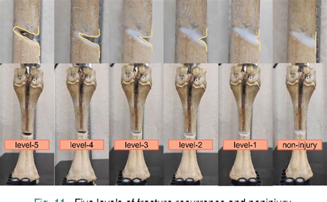 Figure 11 From An Active Fracture Diagnosis System With Biocompatible
