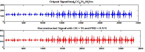 Reconstructed Fetalpcgp21gw39m Based On The Proposed Algorithm