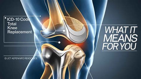 Total Knee Replacement Icd 10 Code What It Means For You