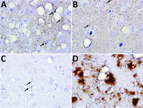Immunohistochemical Analyses Of Disease Associated Prion Protein Prp Download Scientific