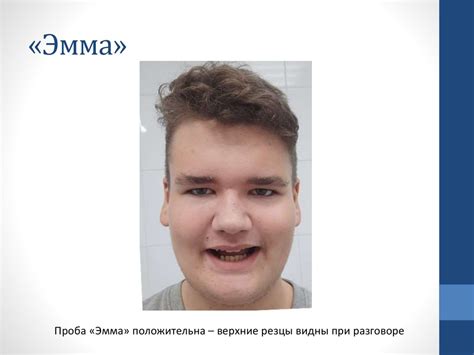 Диагностика. Фотографии лица до лечения - презентация онлайн