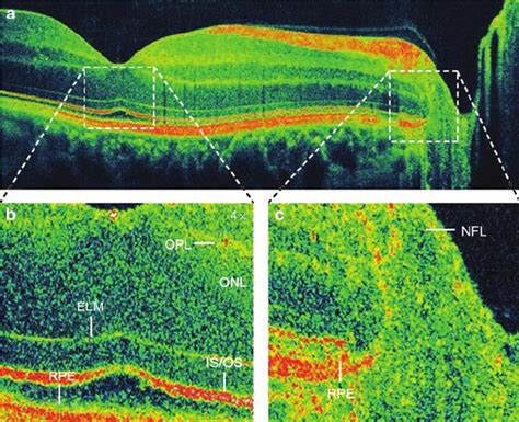 High Definition Ultra High Resolution Oct Scans The High Data Download Scientific Diagram