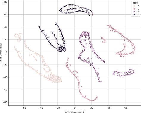 Conception And Realization Of An Iot Enabled Deep Cnn Decision Support System For Automated